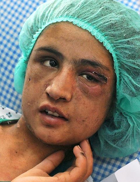 Tortured Afghan bride was sent back - Taipei Times